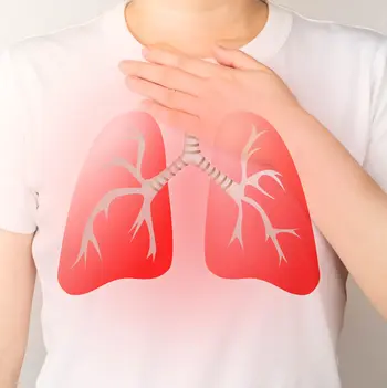 What are the 4 Stages of Pneumonia? | LifeMD
