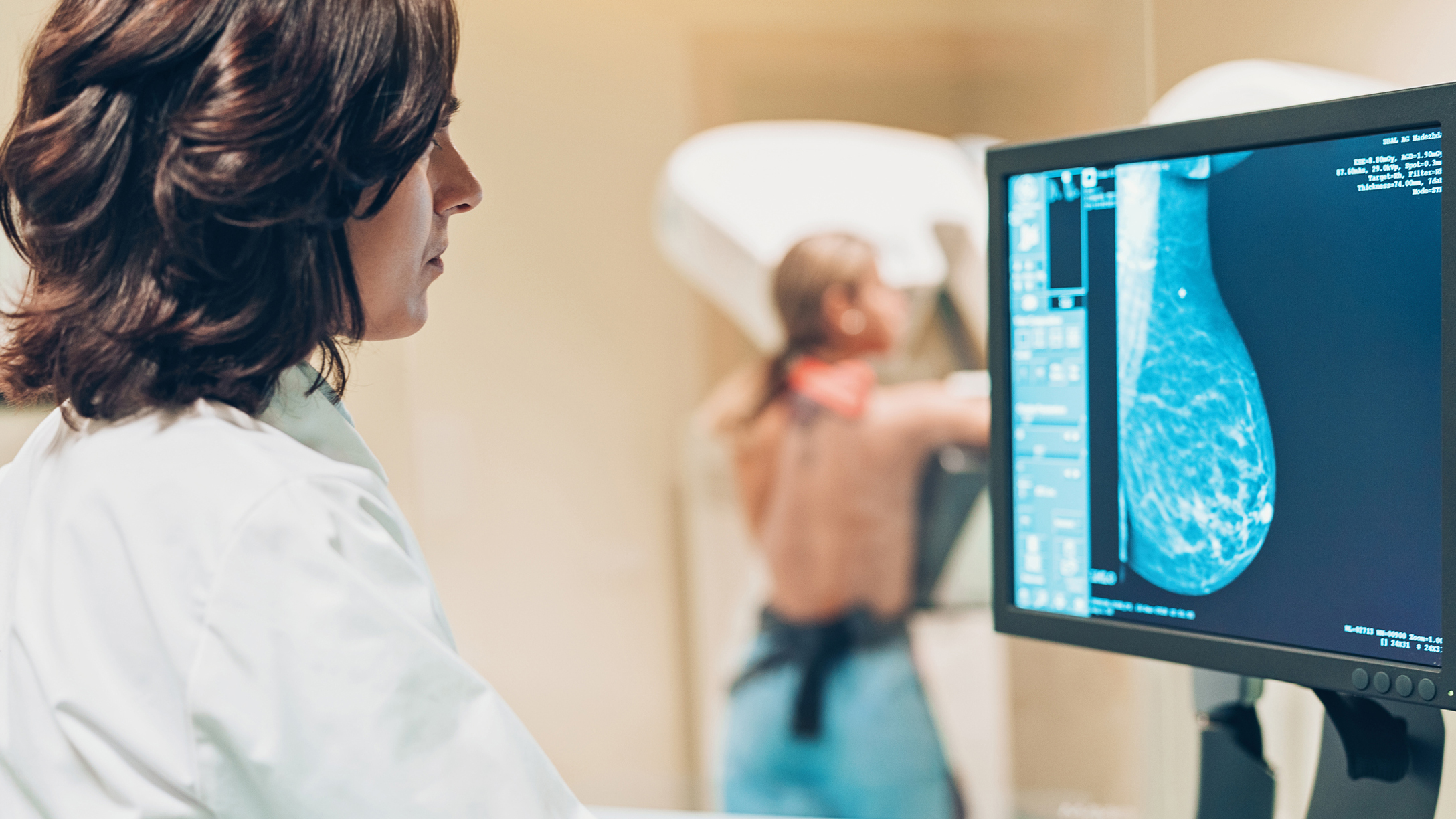 Everything You Need to Know About Getting a Mammogram | Mom.com