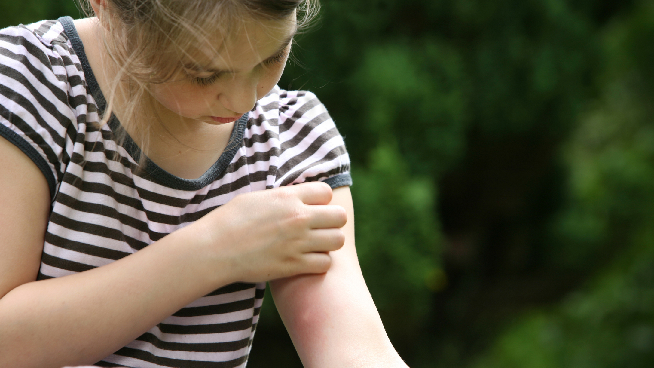 What To Do If Your Child Is Bitten by a Tick | Mom.com