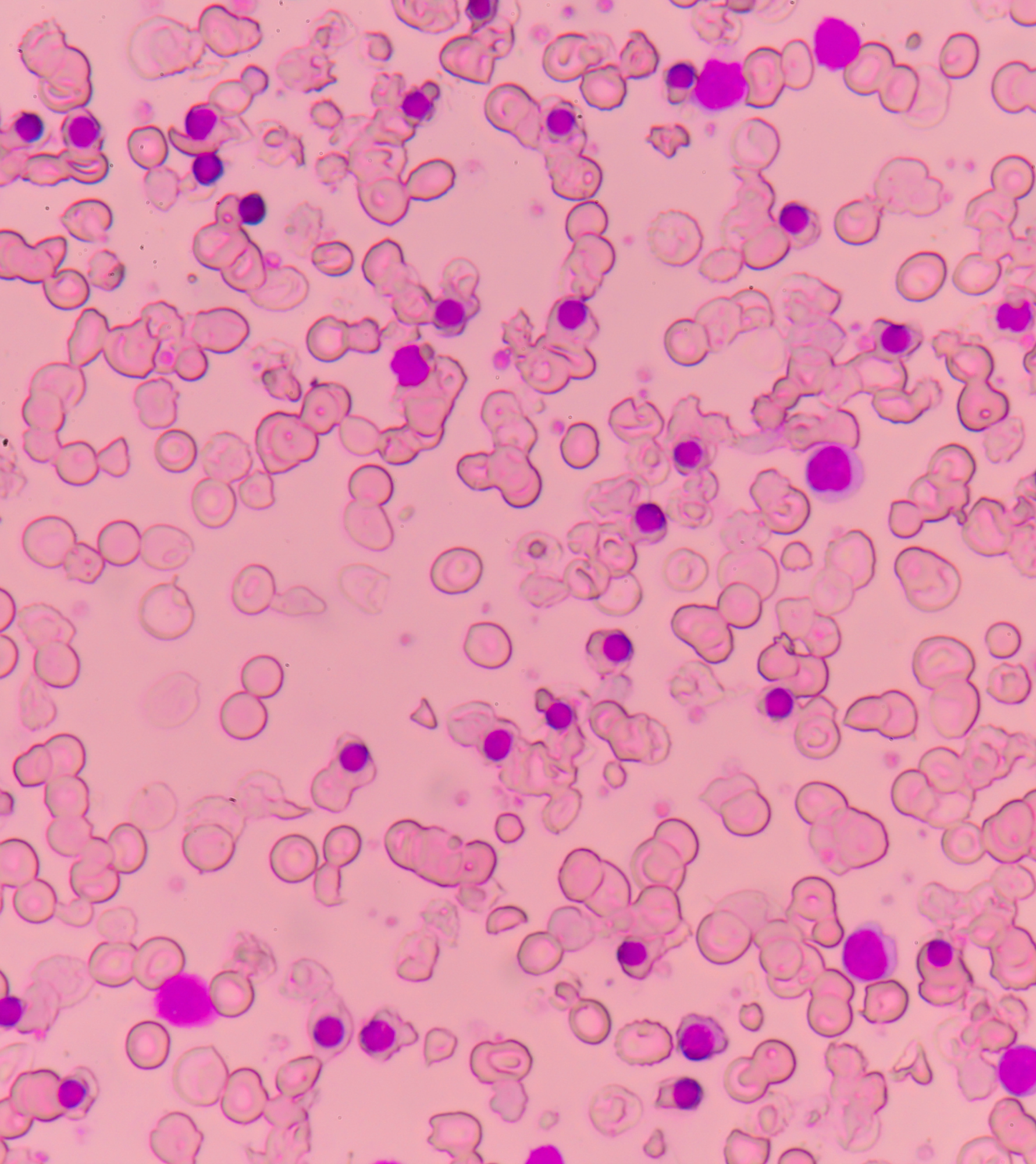 19 Health Problems That Show Up in Your Nails | Mom.com