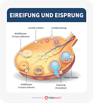 Eileiterteile