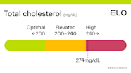 Total Cholesterol 274 Mg dL Total Cholesterol 274 Mg dL
