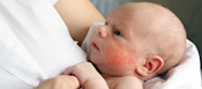 14 Types Of Common Baby Rashes Pampers 14 Types Of Common Baby Rashes Pampers