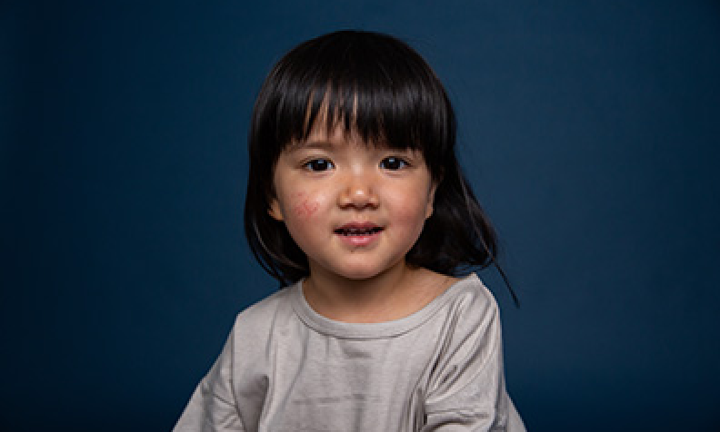 Baby Eczema on Skin of Colour | AVEENO®