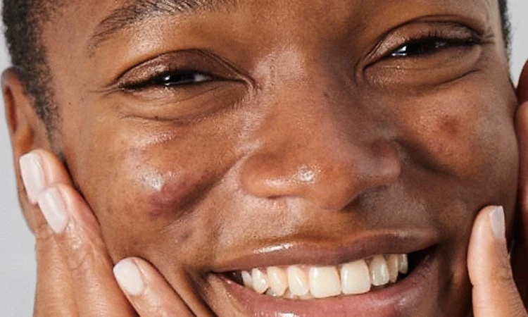 Stubborn Acne Collection | Neutrogena®