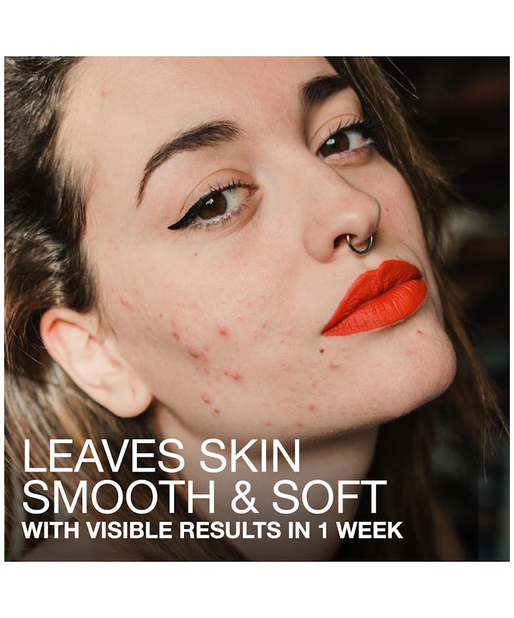 Stubborn Texture™ Acne Cleanser for Textured Skin