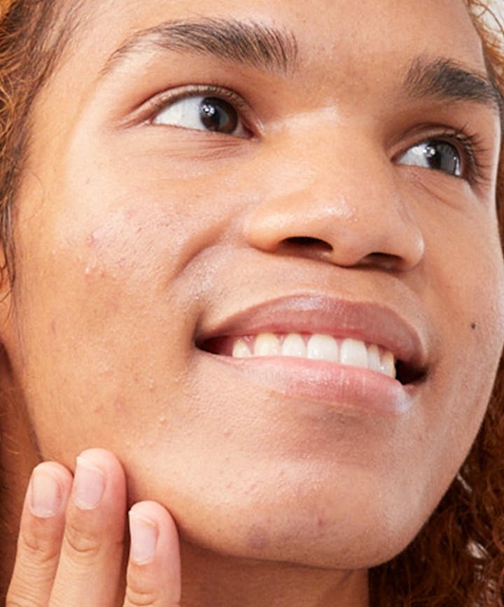 Stubborn Texture™ Liquid Exfoliating Treatment | Neutrogena®