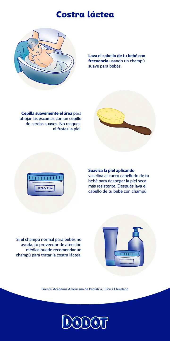 Costra láctea en bebés: causas y tratamientos | Dodot