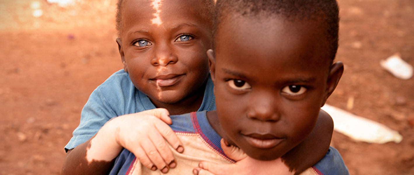 The Story Behind Shakul's Striking Eyes | Compassion