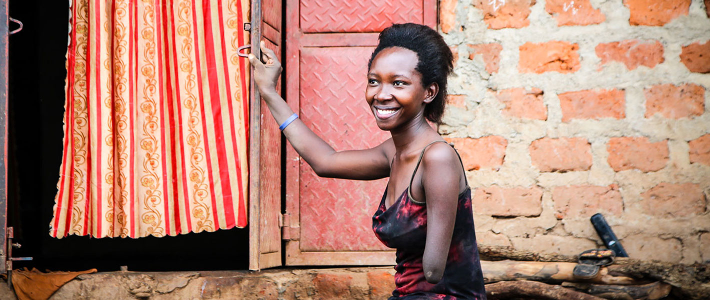 Born Missing Limbs, This is How Grace Lives Without Limits