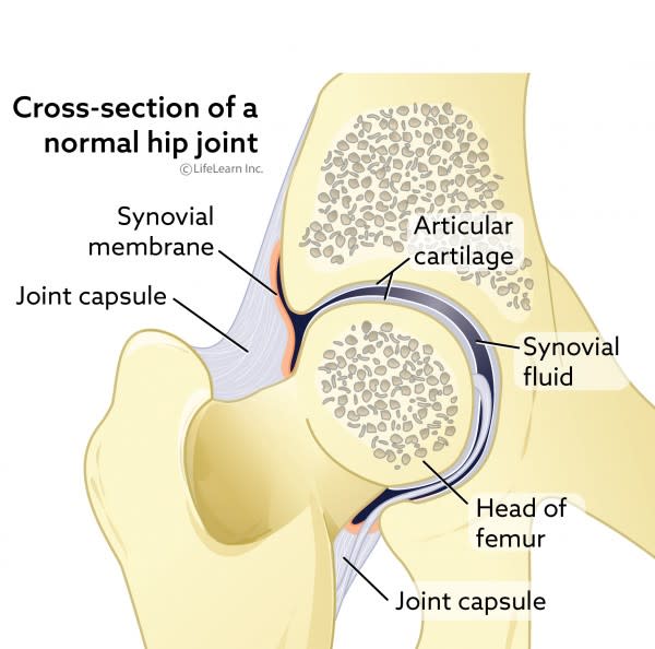 “Illustration of a normal hip joint in dogs, showing a well-formed ball ...