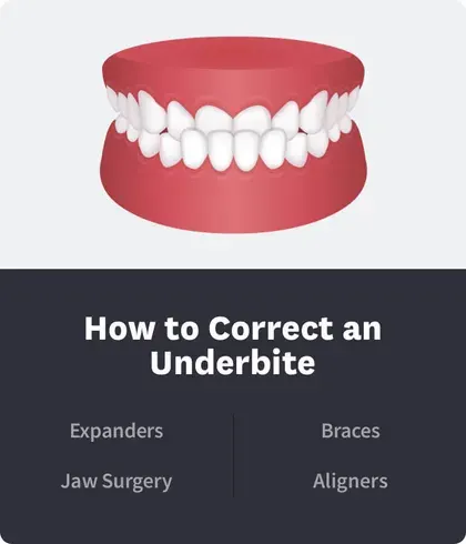 How To Correct Underbite : A Helpful Guide on How to Fix Underbites ...
