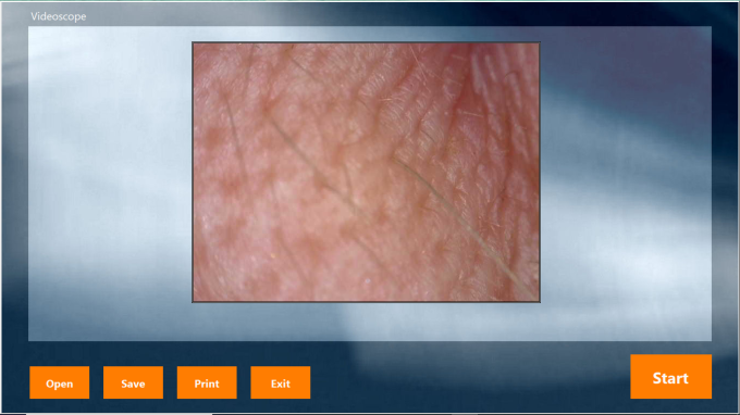 Professional skin microscope - Cortex Technology