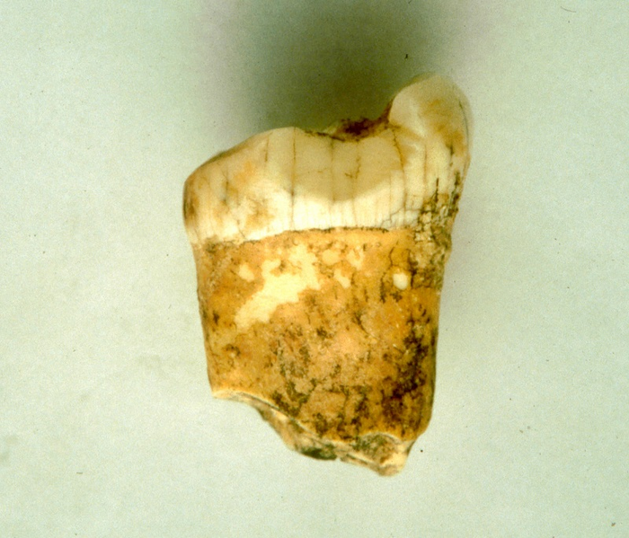 Neanderthals Were Probably Carnivorous According To A Fossilized Tooth Discover Magazine