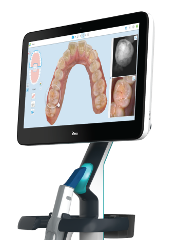 iTero Element™ intraoral scanners | iTero