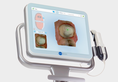 Certified Pre-Owned Scanners | iTero