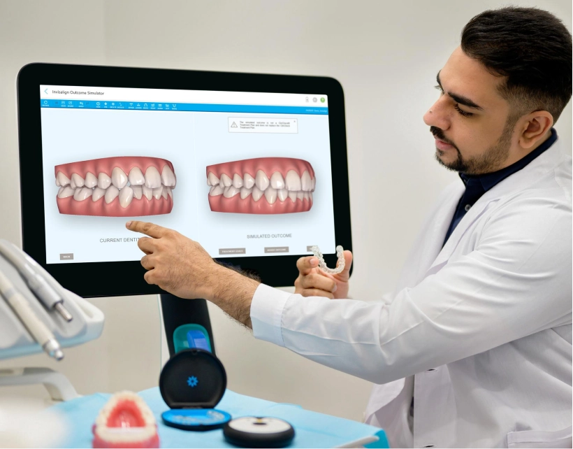 Dental 3D Intraoral Scanners | Explore Our Solutions | iTero