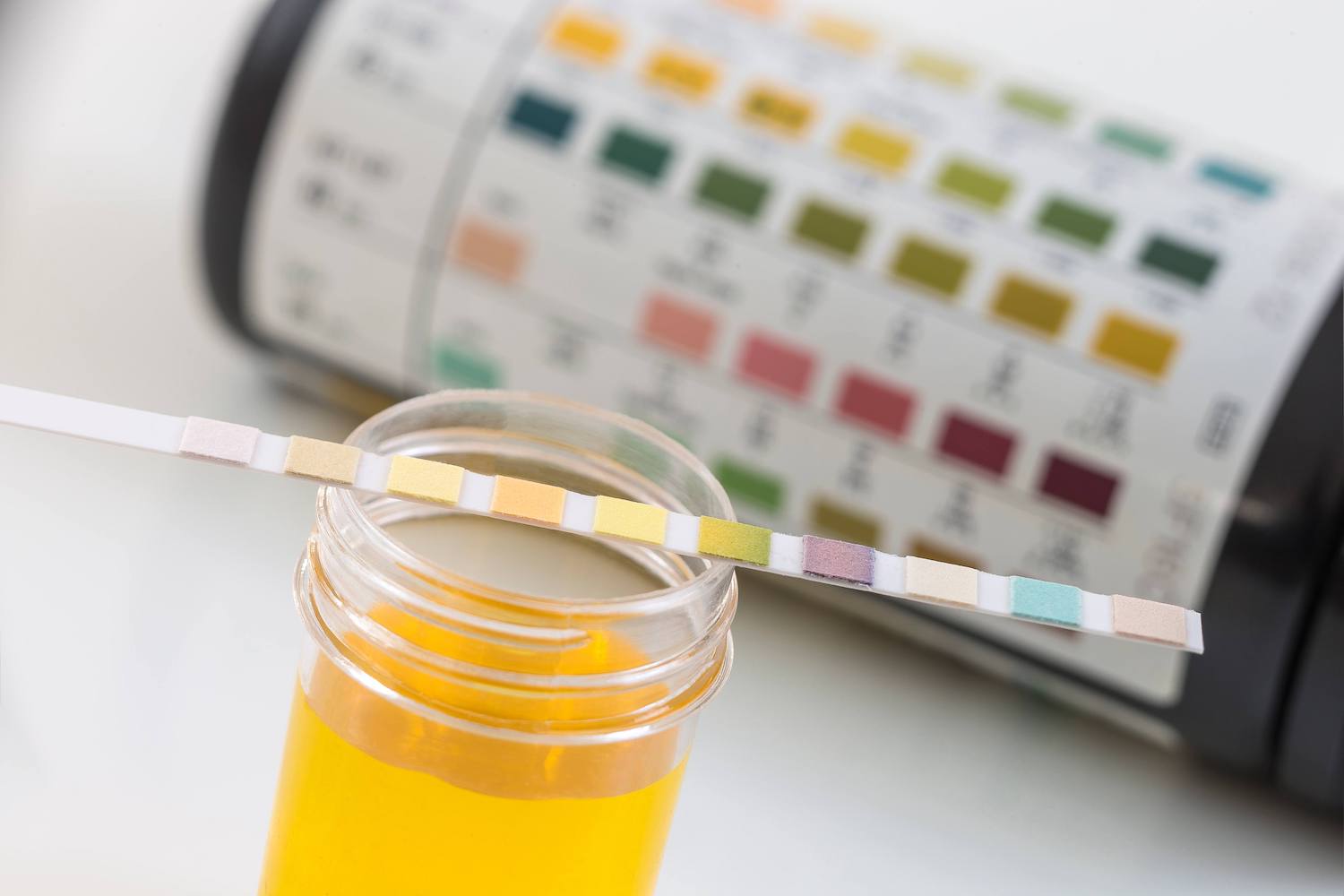London Greek Urology | Blood in the Urine