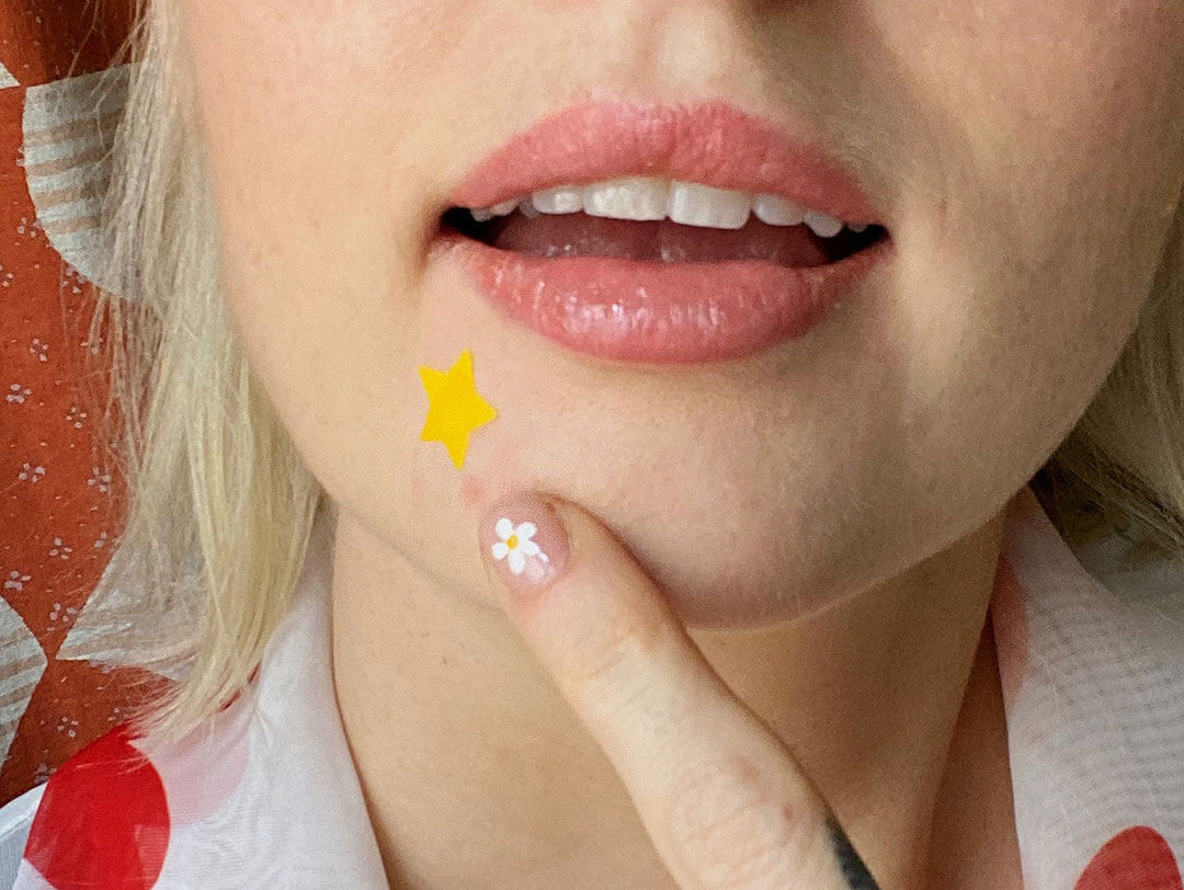 How to Use Pimple Patches & What to Avoid From Expert | IPSY