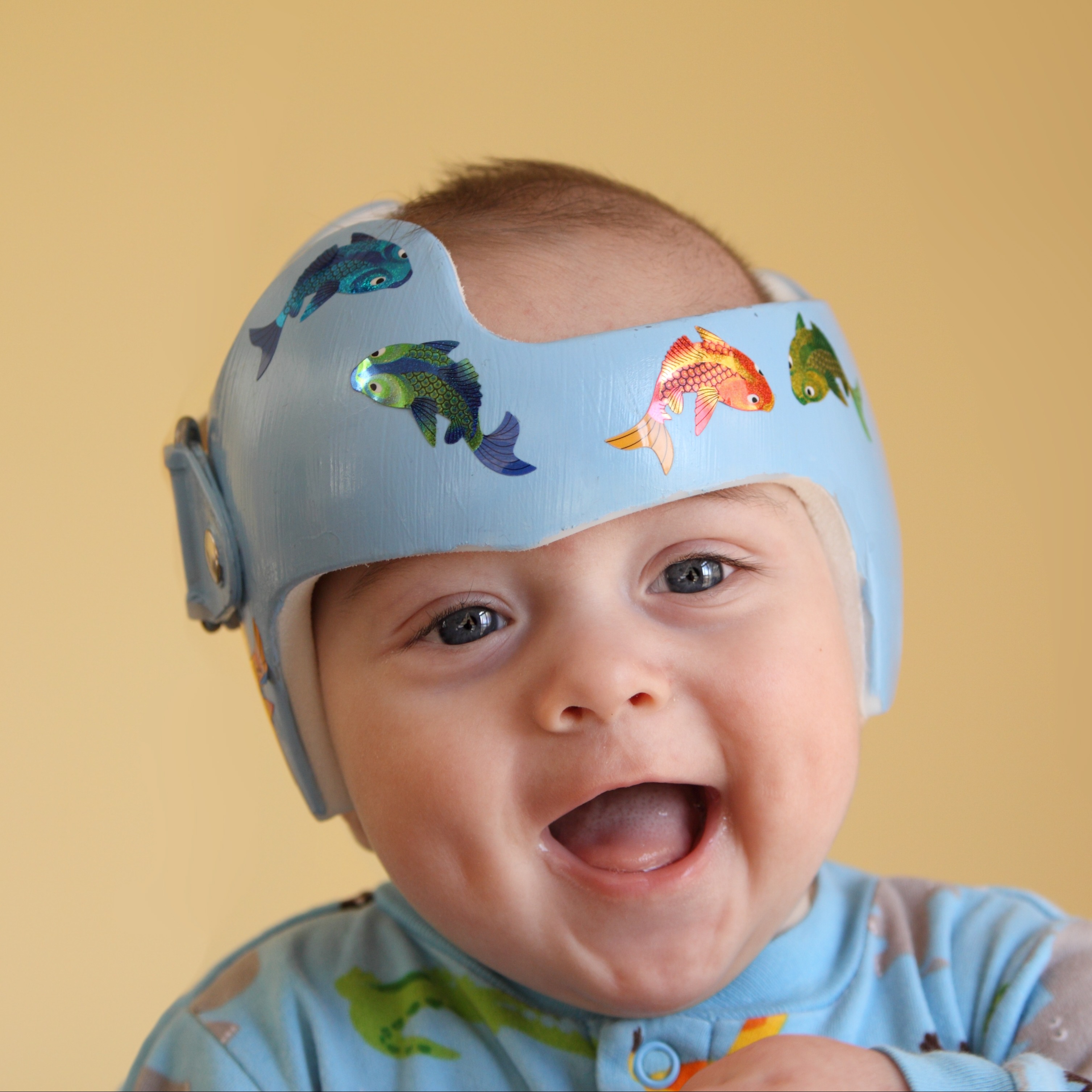 Plagiocephaly and Head Shape Clinic | Children's Nebraska