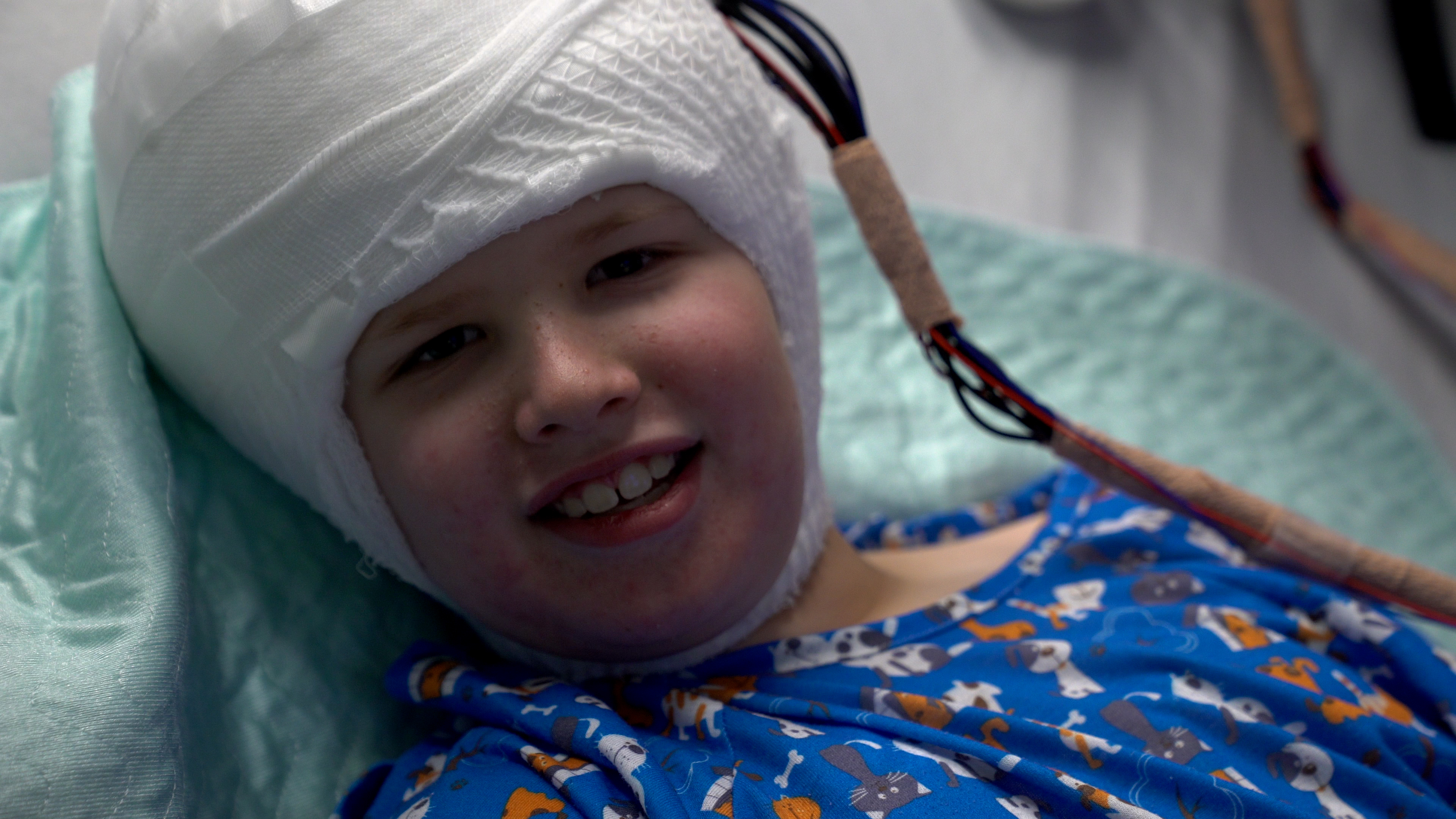 Ethan’s Story: Reducing Seizures Through Surgical Innovation