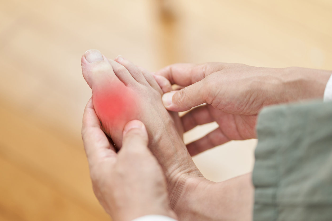 Does Medicare Cover Cartiva Implants?