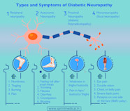 Proximal Neuropathy Proximal Neuropathy