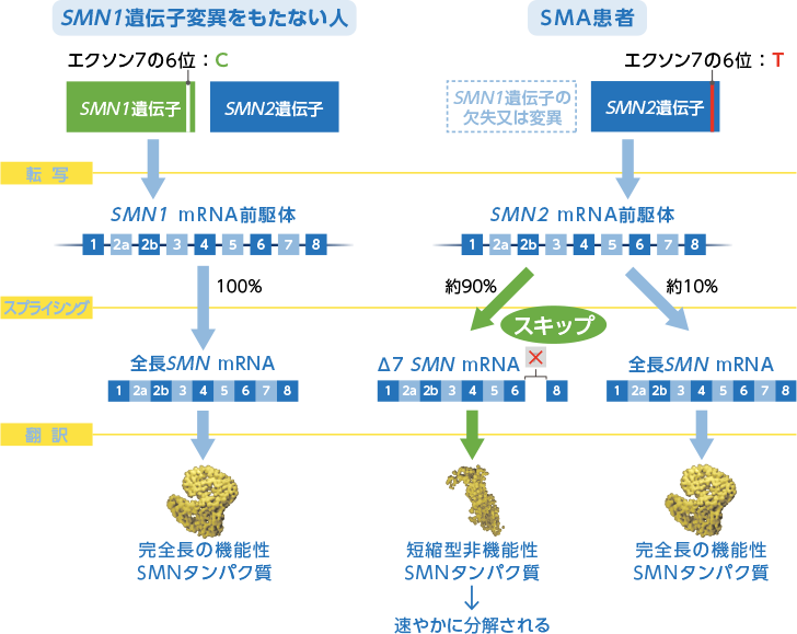 SMAの原因・診断｜SMAについて知る｜診断サポート｜脊髄性筋萎縮症(SMA)｜BiogenLinc｜バイオジェン