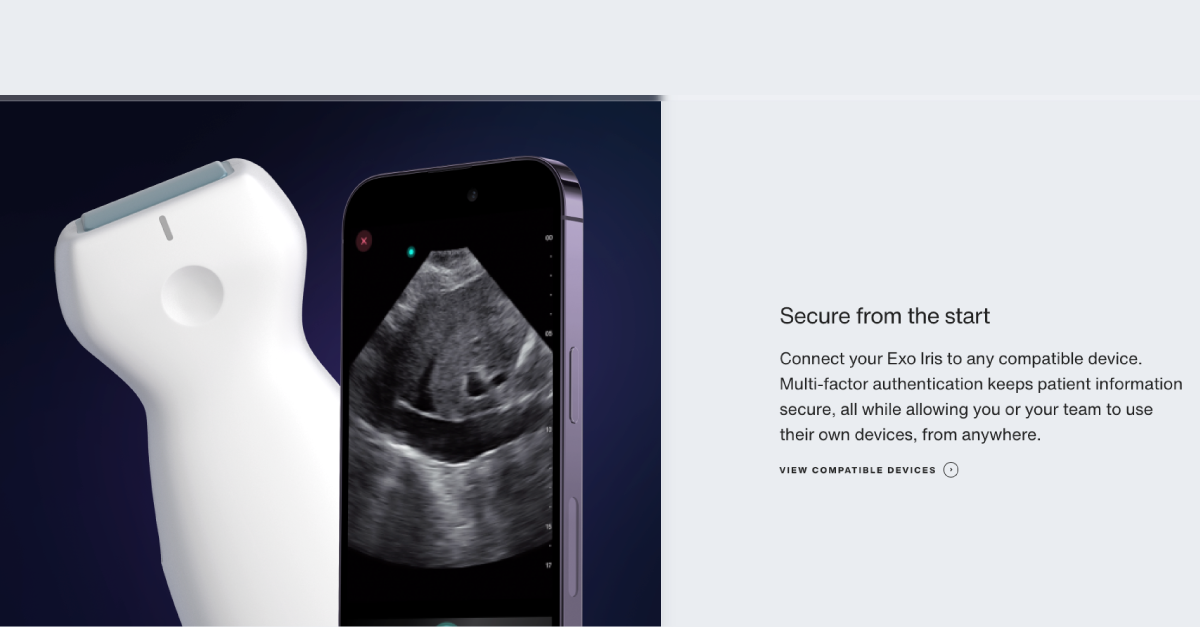 Exo Iris® | Vendor Neutral EHR Integration for POCUS | Exo