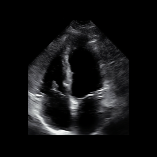 Exo Iris™ | Handheld Ultrasound | Exo