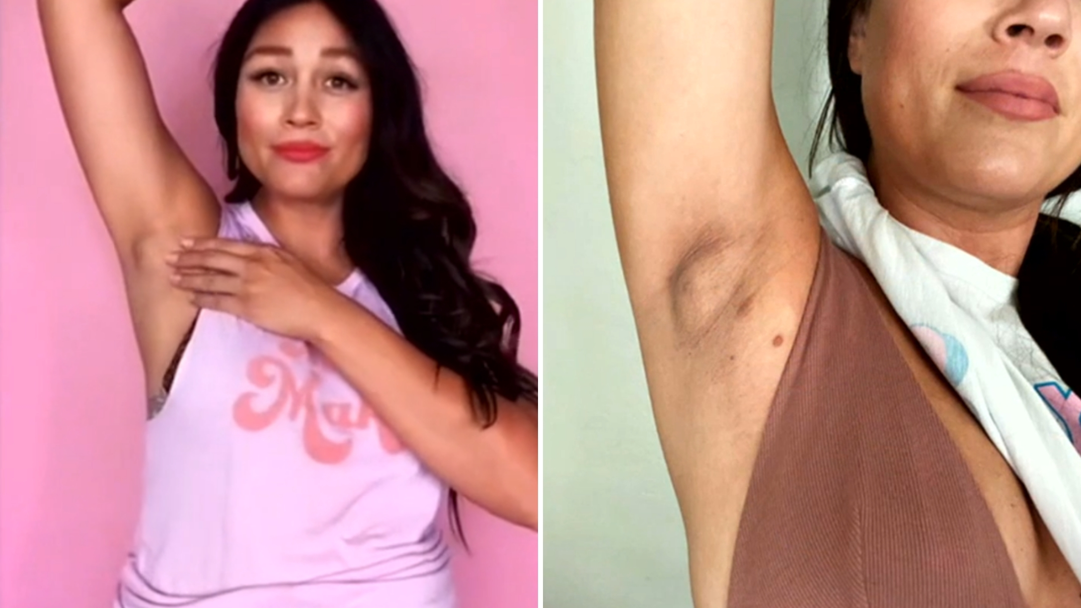 Woman Asks 'The Doctors' Why She's Lactating From Her Armpit And It's ...