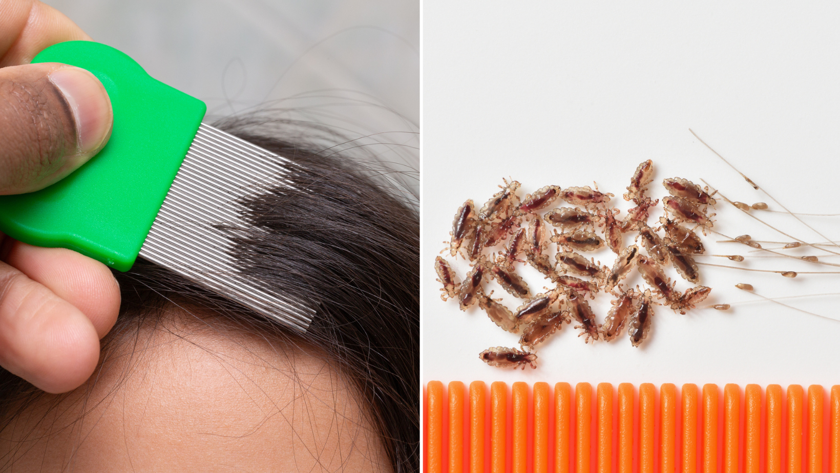 Head Lice Experts Report Cases Of Head Lice Are Increasing ...