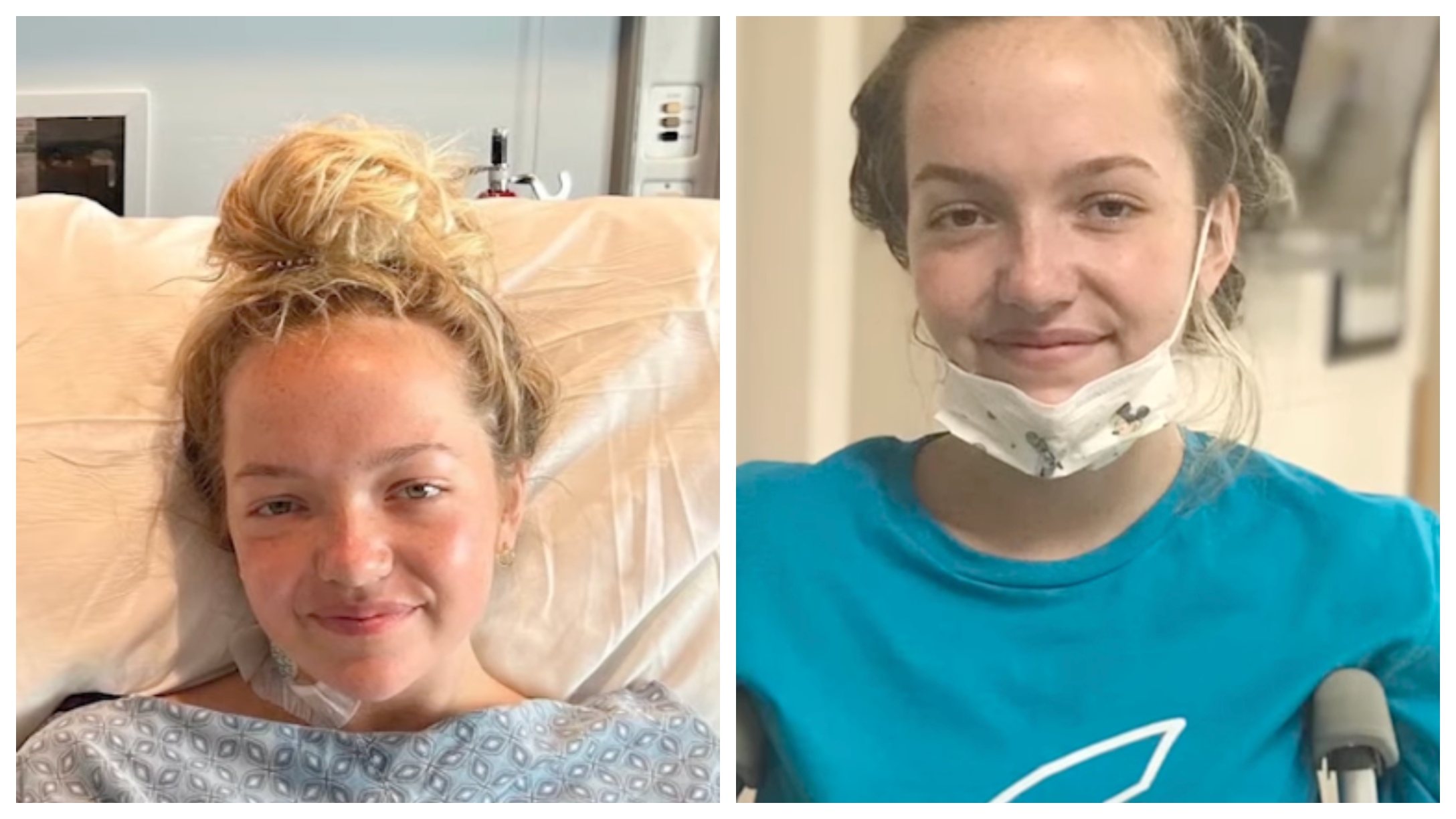 High School Student Who Lost Her Leg In A Shark Attack Reflects 1 Year ...