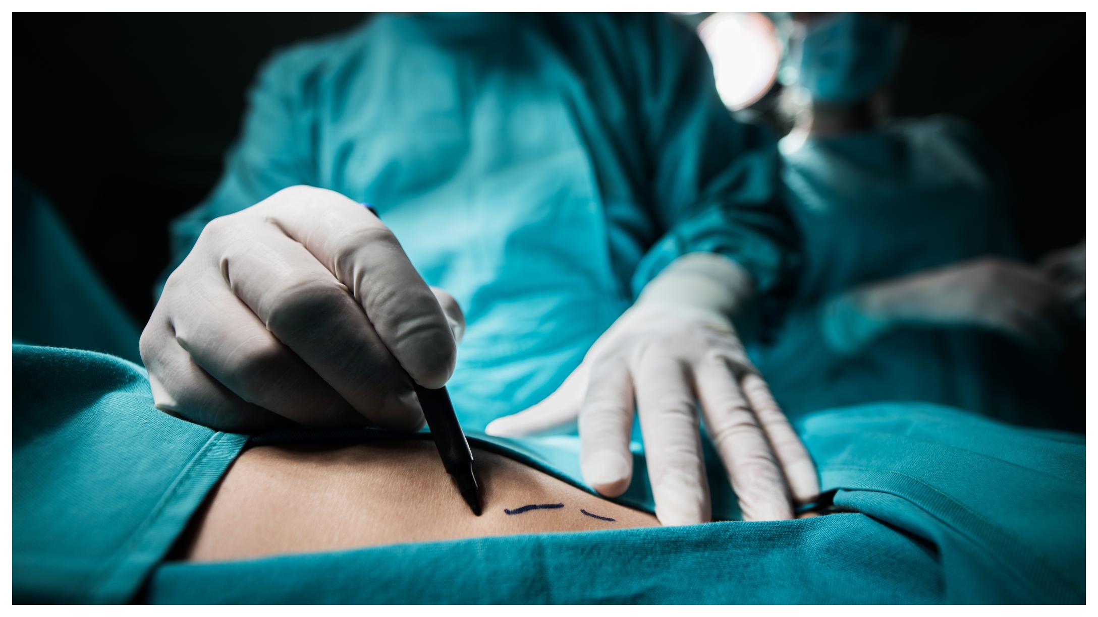 Mom Of 2 Dies After Botched Liposuction Procedure | LittleThings.com