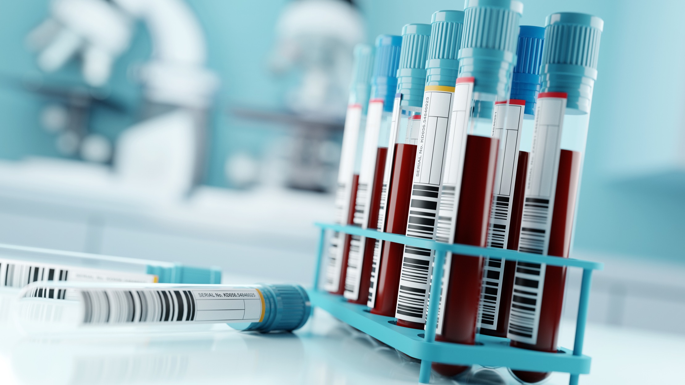 New Blood Tests Can Possibly Be Used For Early Cancer Detection ...