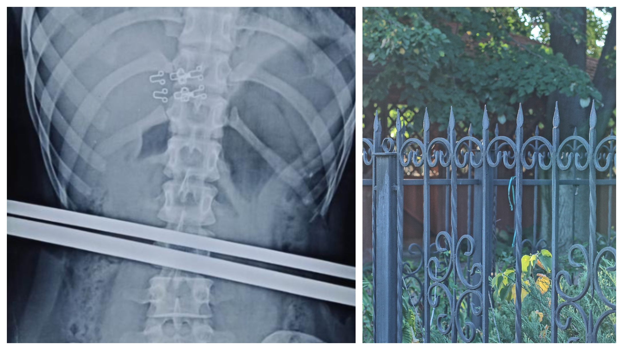 Woman Being Attacked By Monkeys Is Impaled By Steel Rod | LittleThings.com