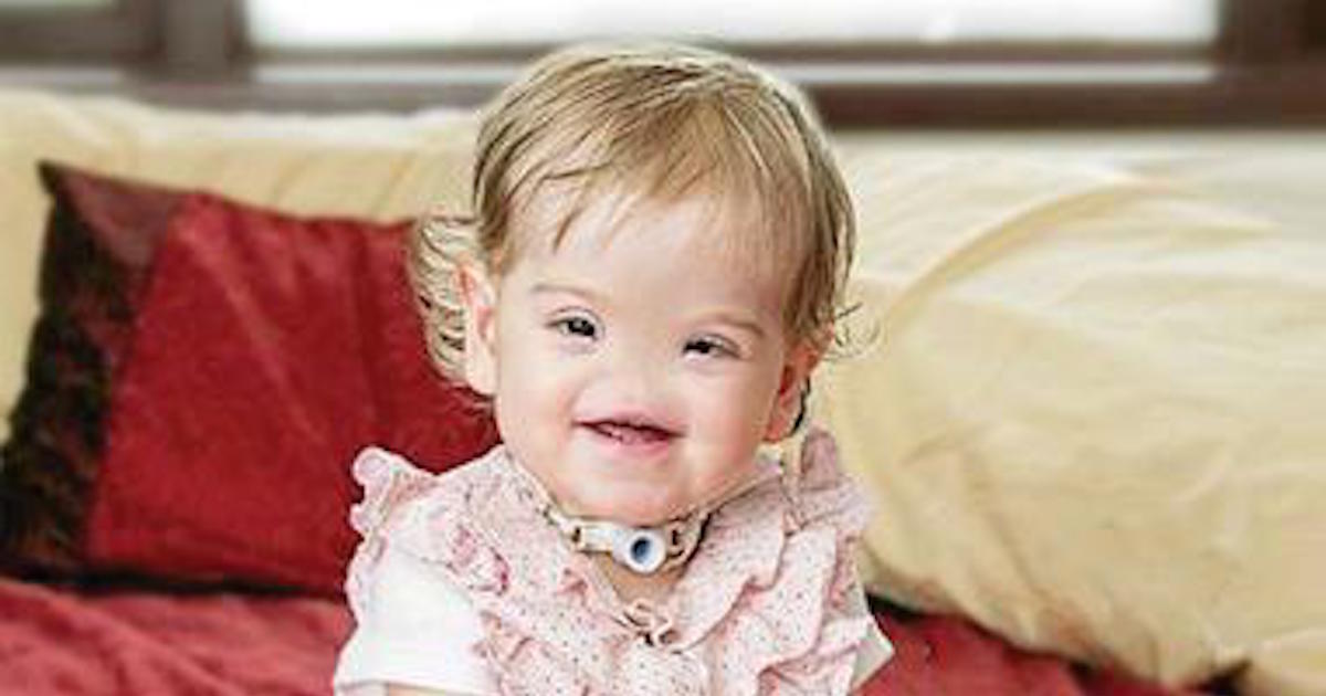 Mom Says She Felt Guilty After Her Daughter Was Born Without A Nose ...