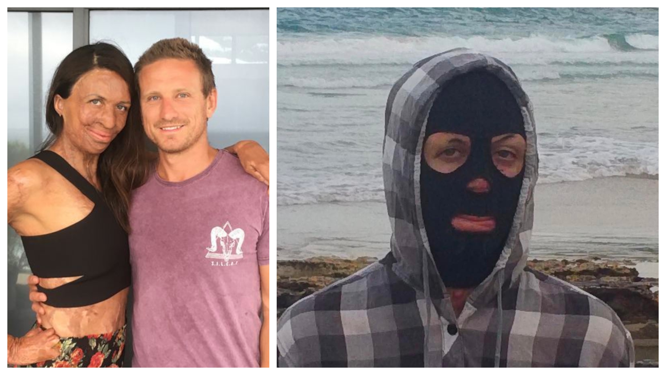 Woman Famous For Surviving Fire Attack Unveils Miracle Baby ...