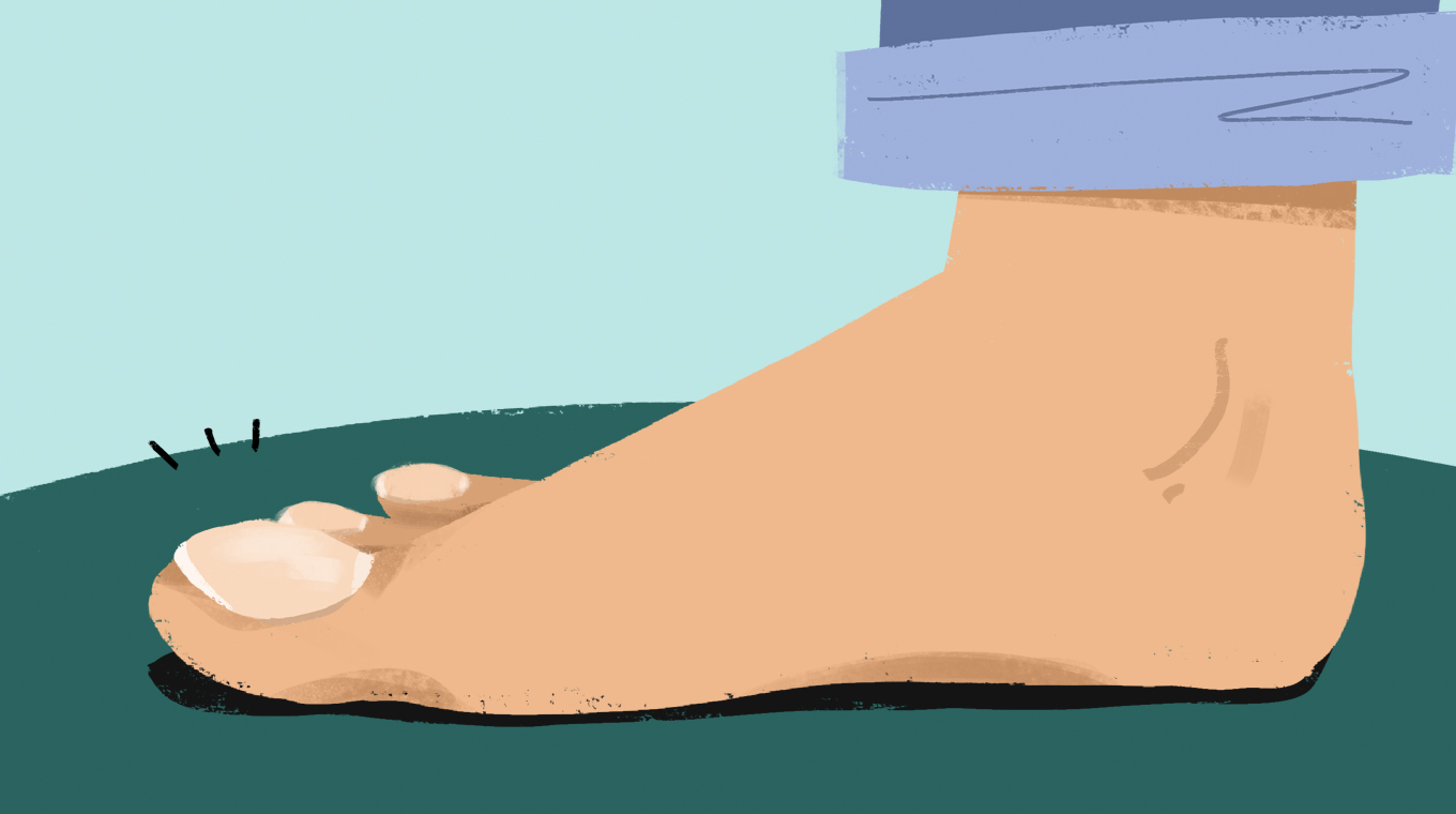 10 Things Your Feet Are Trying To Tell You About Your Health ...