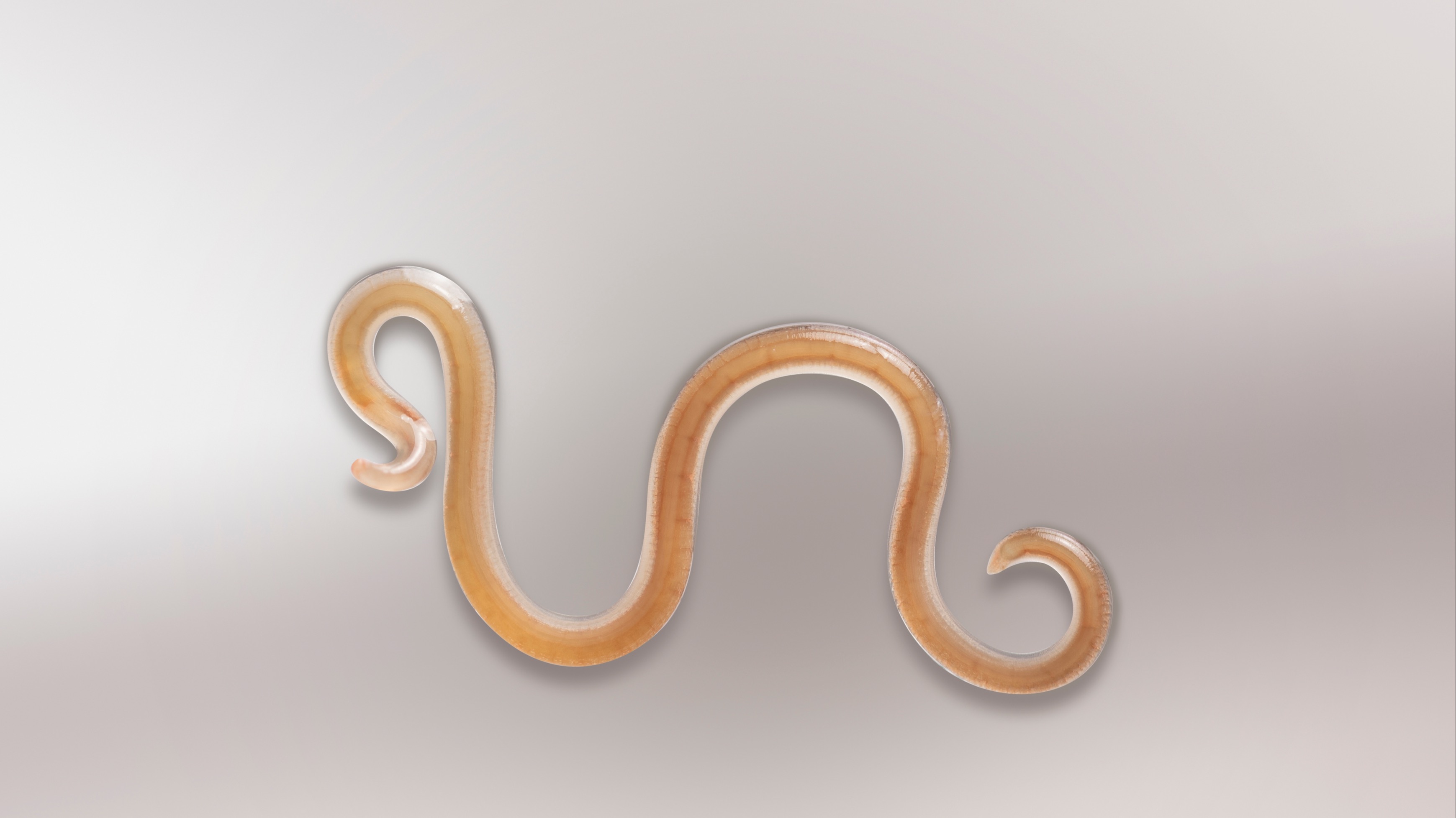 Woman Becomes 'Accidental Host' After Live 3-Inch Worm Found In Her ...