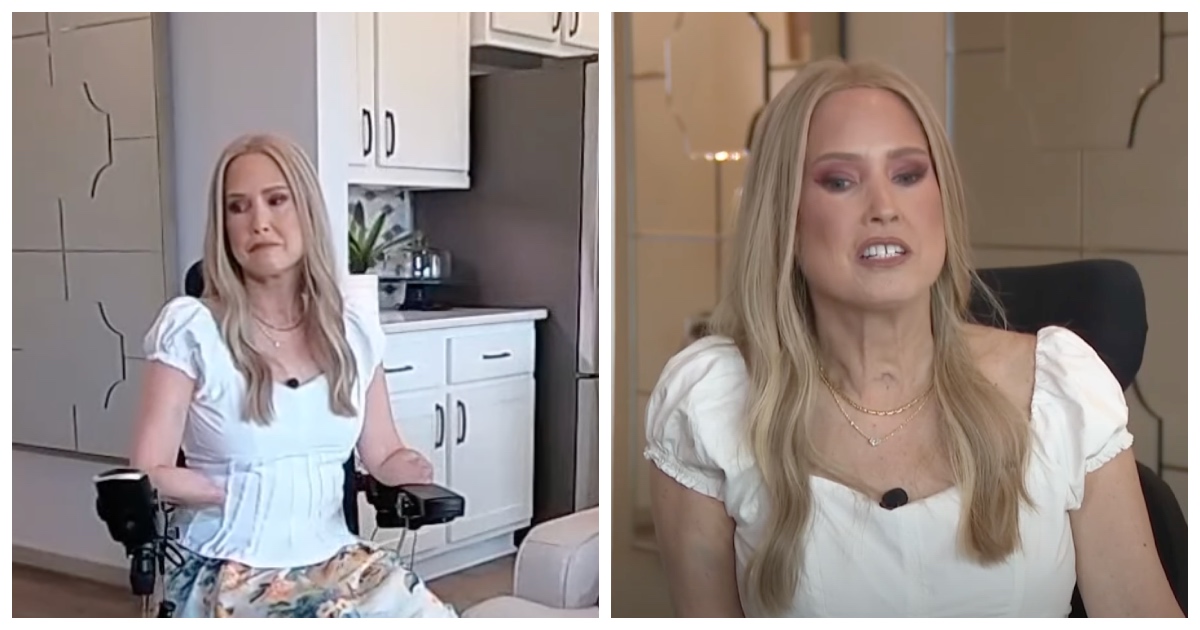 Woman Loses Legs And Arms Due To Sepsis From Strep Infection ...