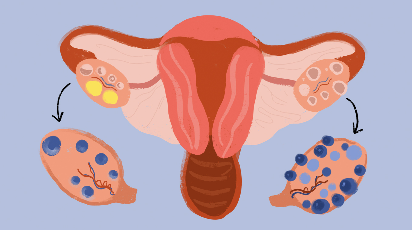 What Your Chin Hair Might Mean And How To Get Rid Of It | LittleThings.com