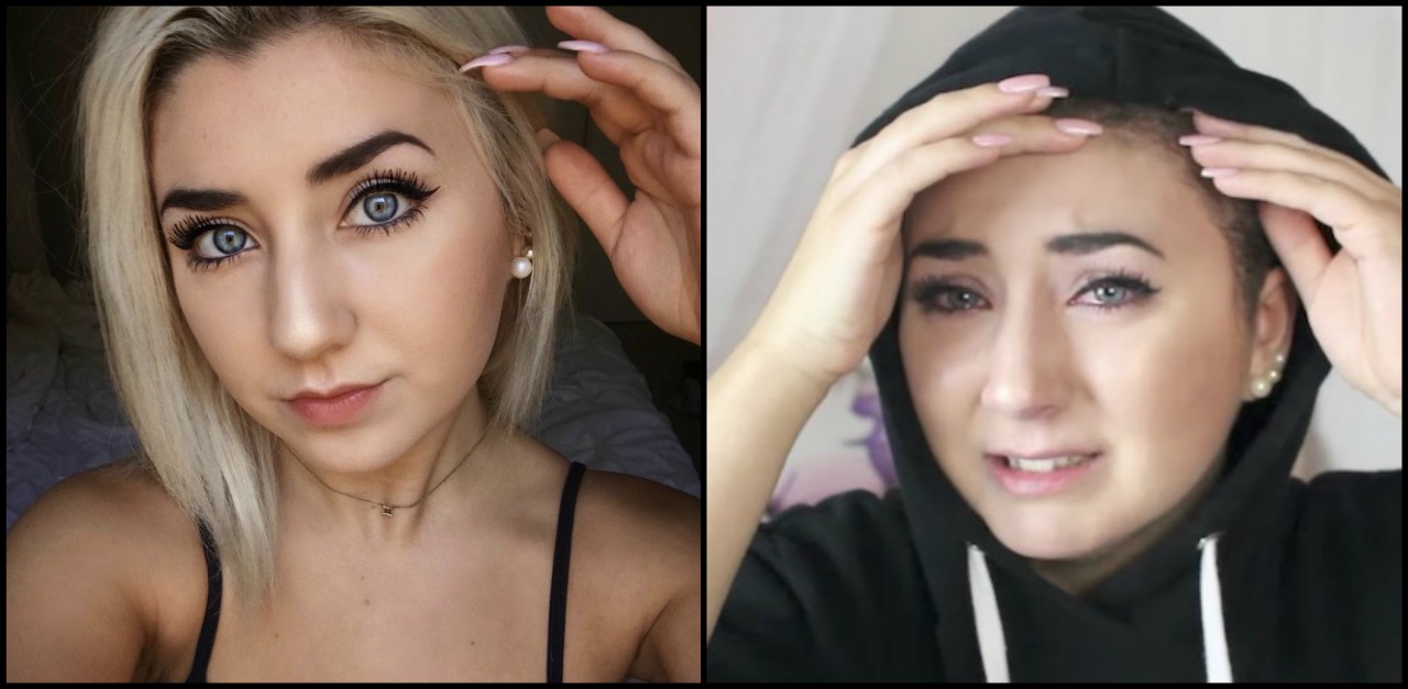 Girl Shares Traumatic Story About Hair Burning Off | LittleThings.com