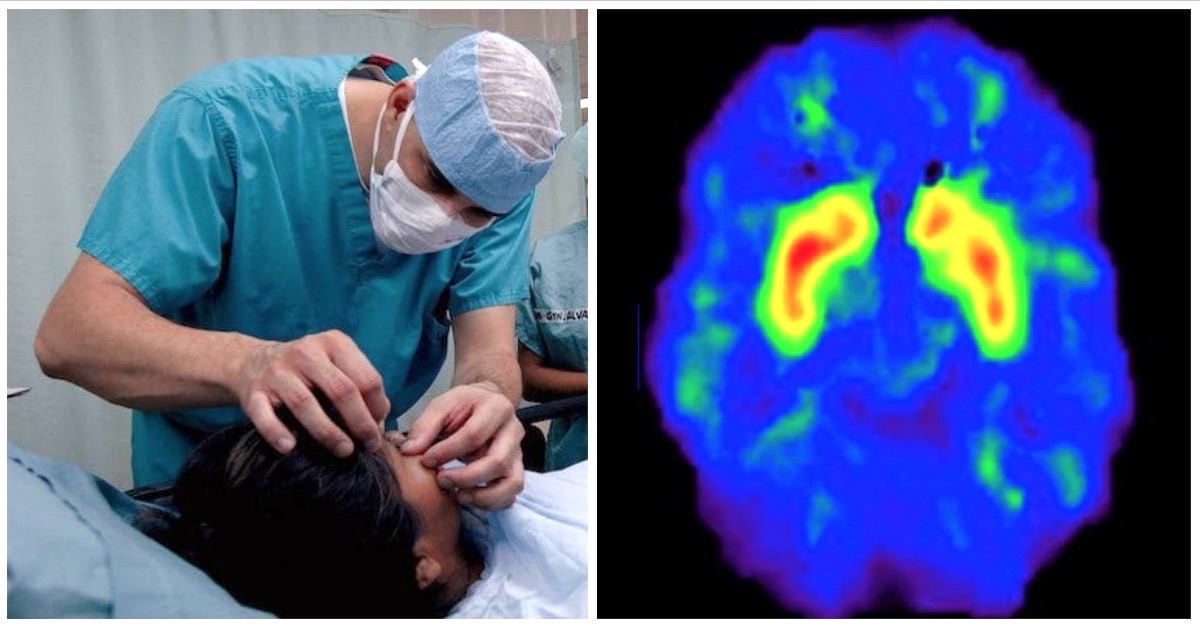 New Research Says Your Brain Is Still Active After Death | LittleThings.com