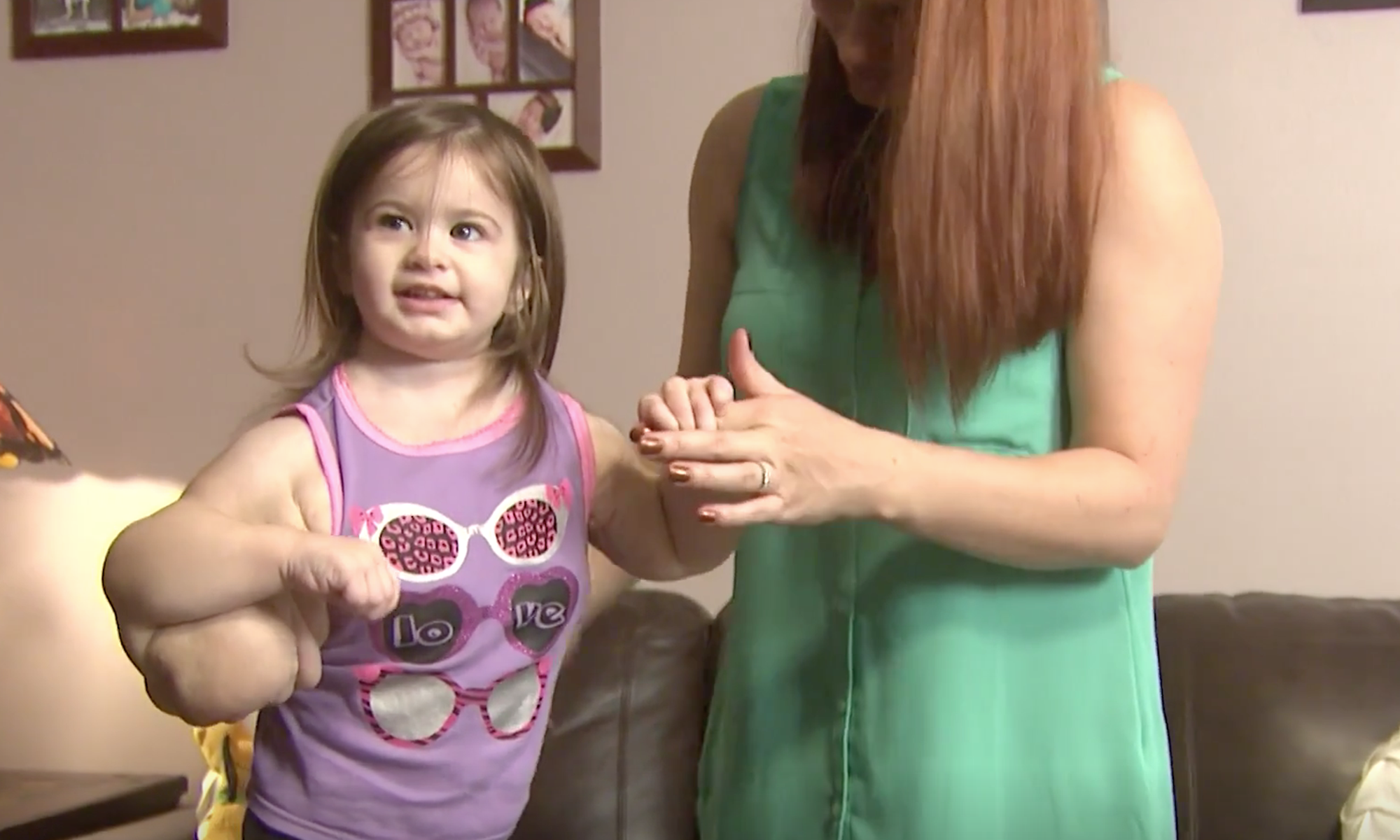 Baby With Rare Disorder Is Born Looking A 'Bodybuilder' From The Waist ...