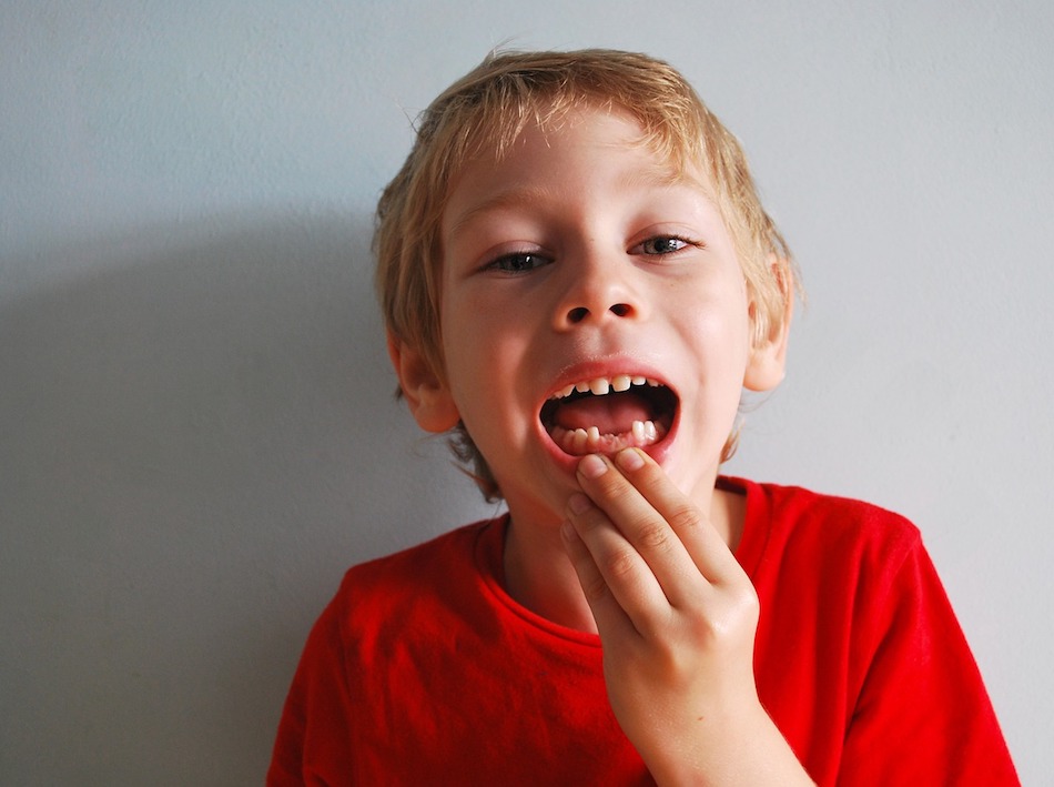 Doctors Are Urging Parents To Keep Their Kids' Baby Teeth ...