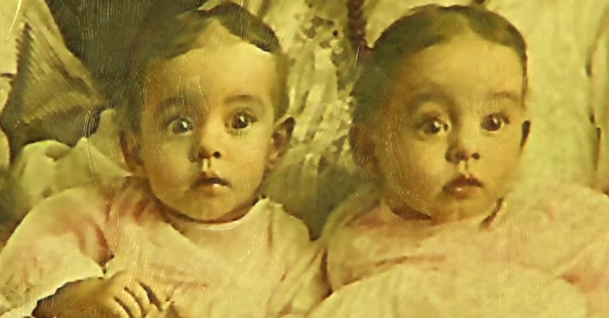 These Twins Were One In 700 Million, But They Didn't Know It Until A ...