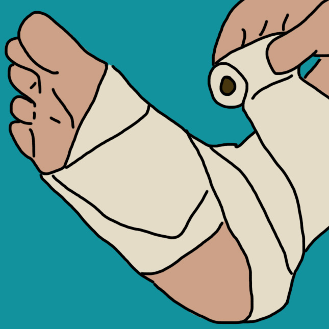 Learn How To Tell And Heal The 5 Different Shades Of Bruises ...