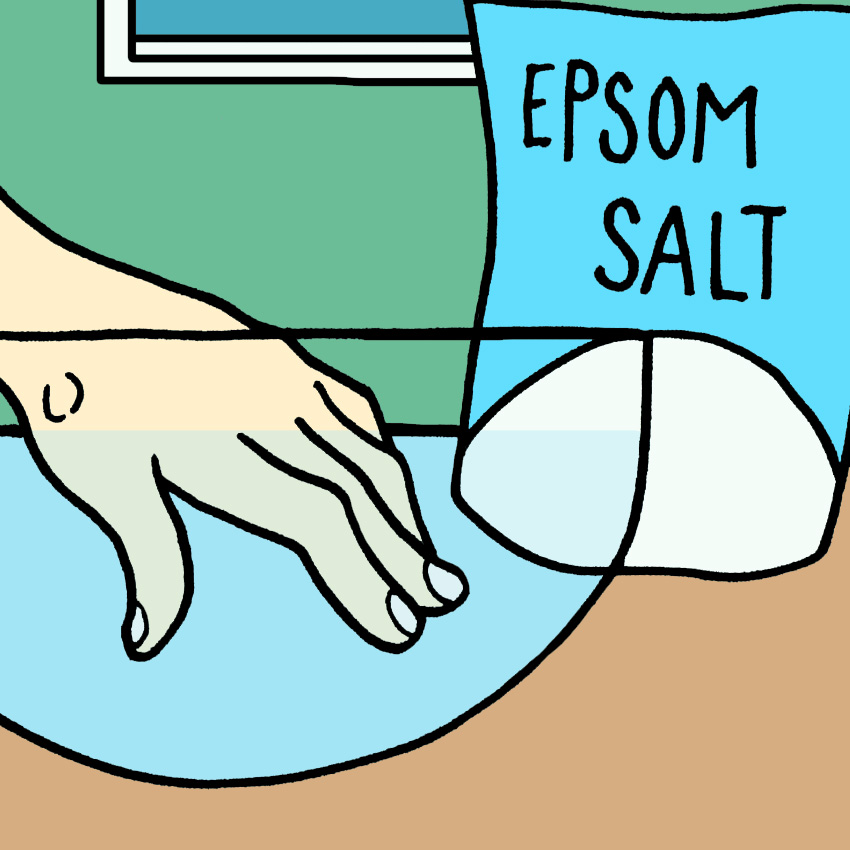 Sebaceous Cysts: Here's How to Safely Get Rid Of Them At Home ...