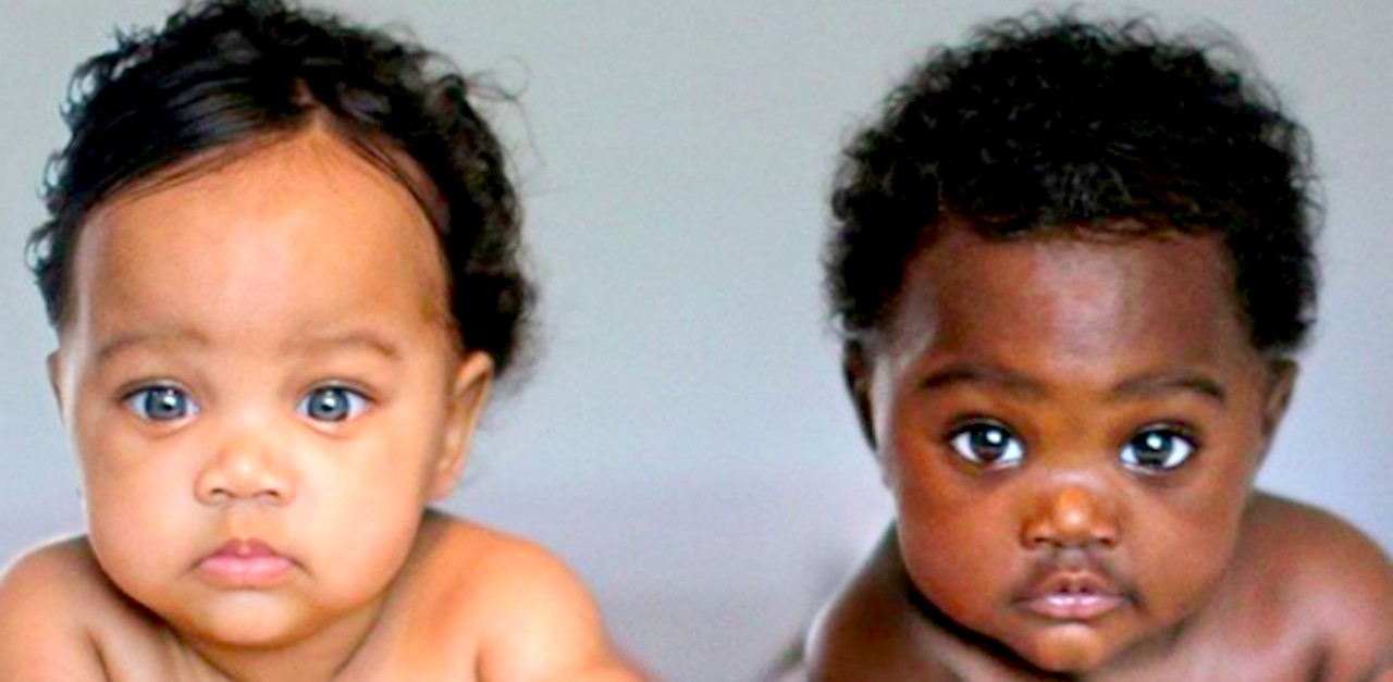 Mom Shares Photos Of Twins With Different Skin Tones | LittleThings.com